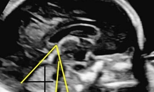 OCT – PRACTICAL – 4d – IV Radiology