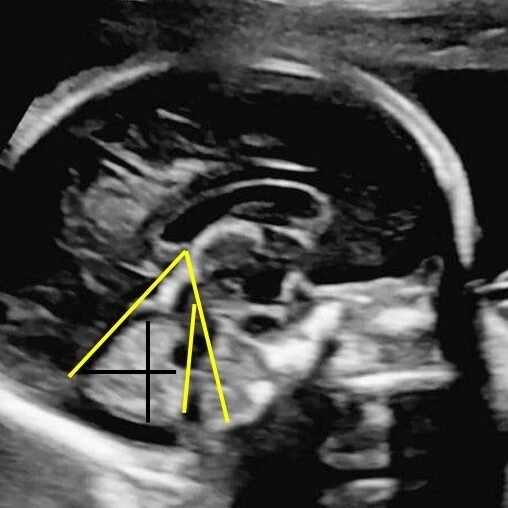 IV Radiology – Intravenous Radiology Courses