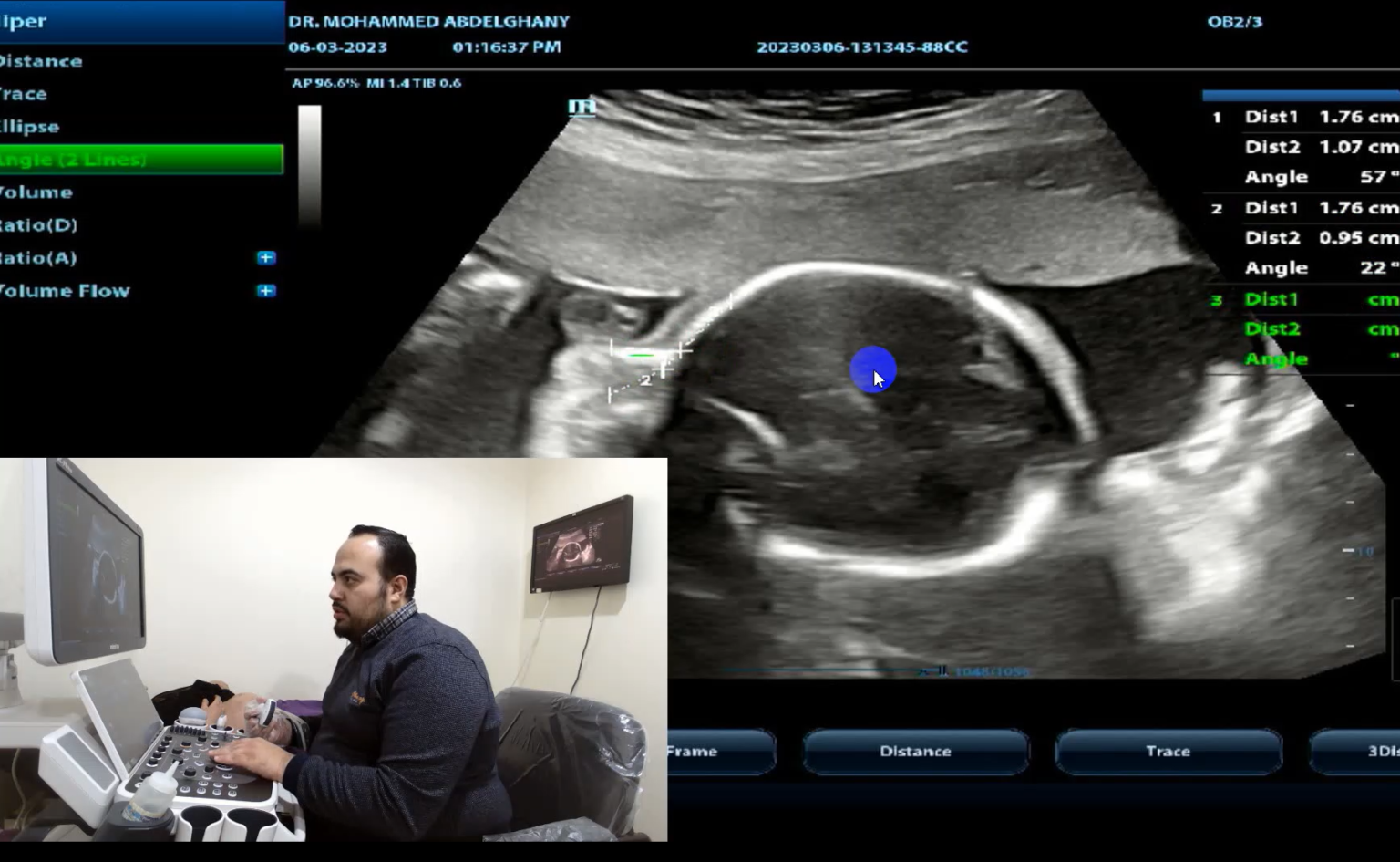 PRACTICAL – 4d – IV Radiology