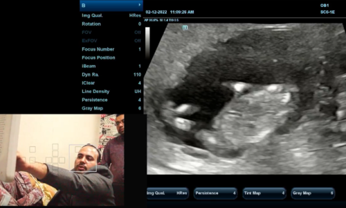 OCT – PRACTICAL – 4d – IV Radiology OCT – PRACTICAL – 4d – IV Radiology